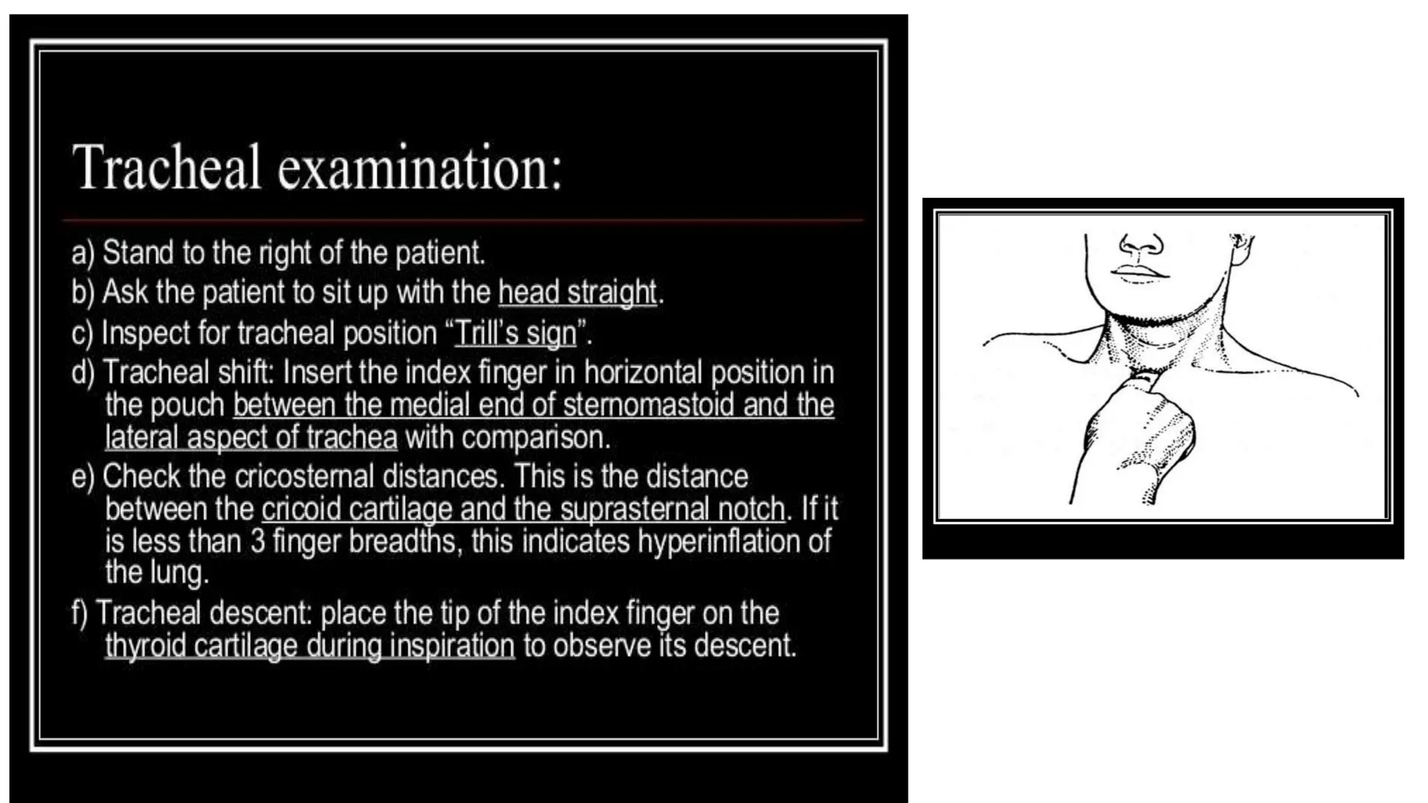 Chest examination clinical practice.pptx