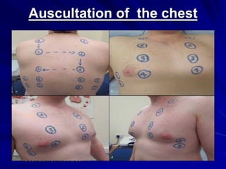 Chest examination magdi sasi2021 | PPT