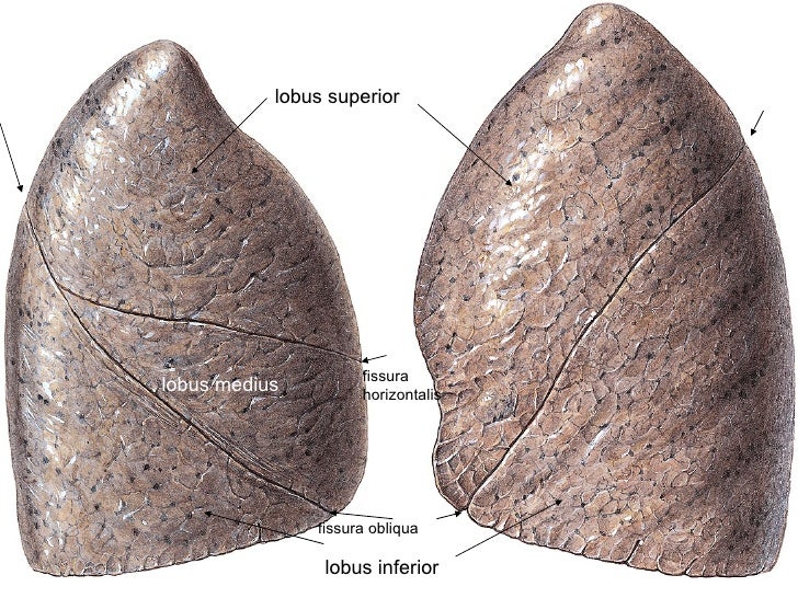 Fejezetek a keresztmetszeti anatómiából - 4. A mellkas és szív keresz…