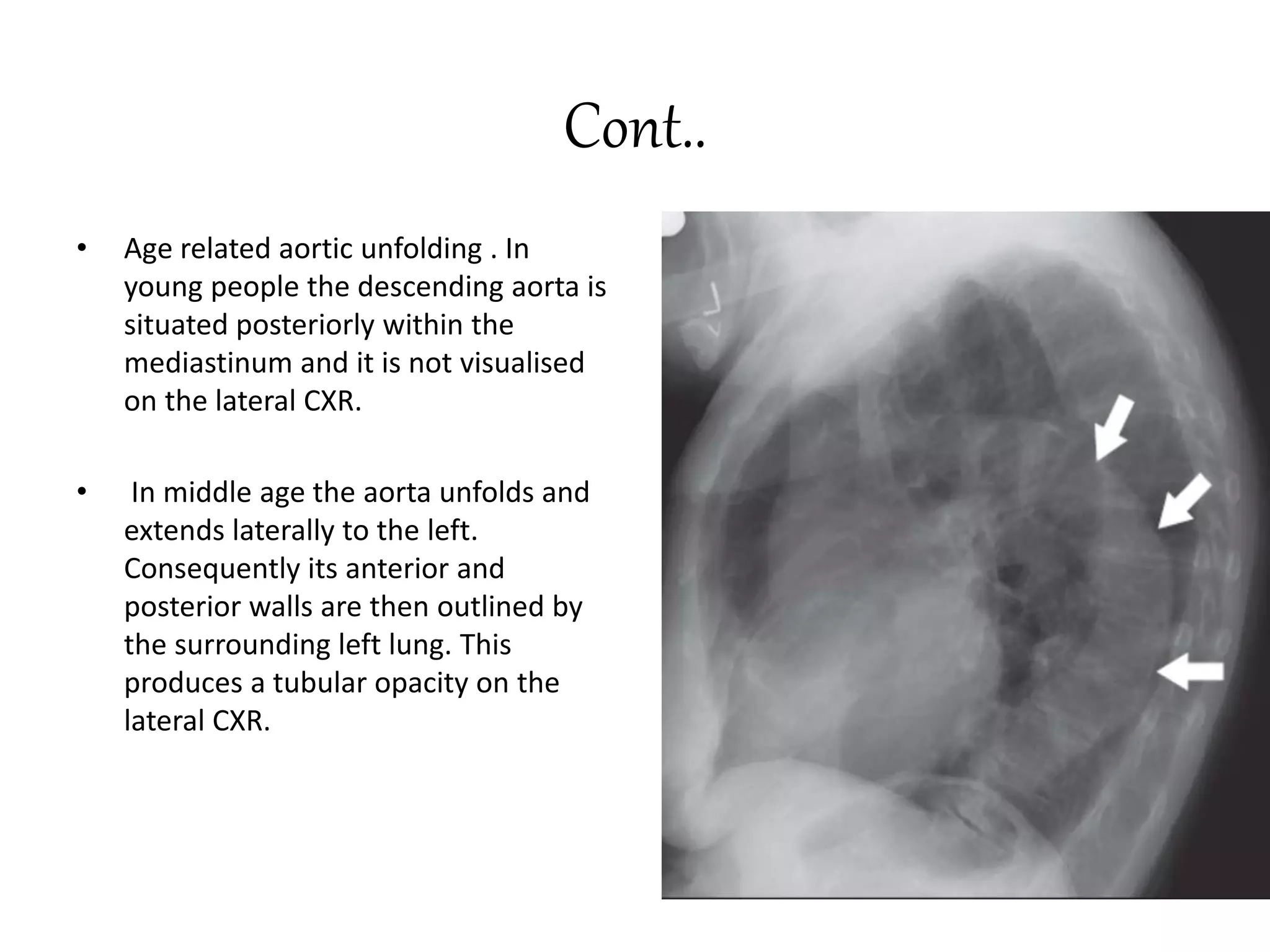 Chest imaging | PPTX
