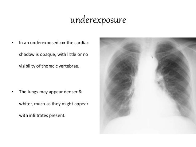 Chest imaging