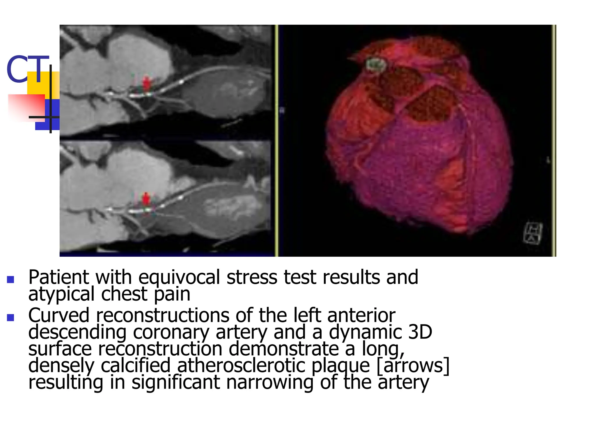 CHEST IMAGING deataied lecture on Radiological investigations of the ...