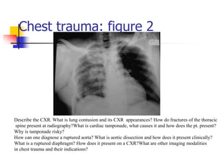 CHEST IMAGING deataied lecture on Radiological investigations of the ...