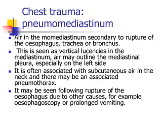 CHEST IMAGING deataied lecture on Radiological investigations of the ...