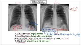 Chest imaging part one radiology lecture .pdf