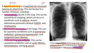 chest imaging lecture 2 in radiology.pdf