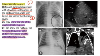 chest imaging lecture 2 in radiology.pdf