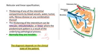 chest imaging lecture 2 in radiology.pdf