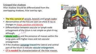 chest imaging lecture 2 in radiology.pdf