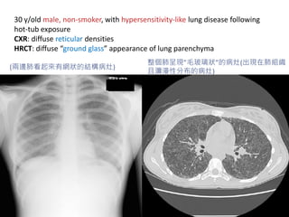 Chest imaging of ntm pulmonary disease2 | PDF