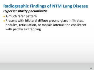 Chest imaging of ntm pulmonary disease2 | PPT
