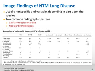 Chest imaging of ntm pulmonary disease2 | PPT