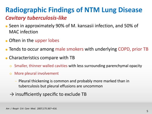 Chest imaging of ntm pulmonary disease2 | PPT