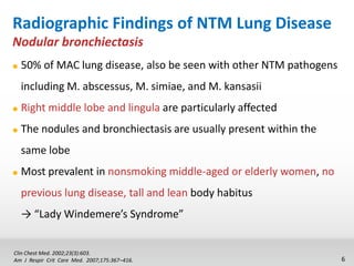 Chest imaging of ntm pulmonary disease2 | PPT