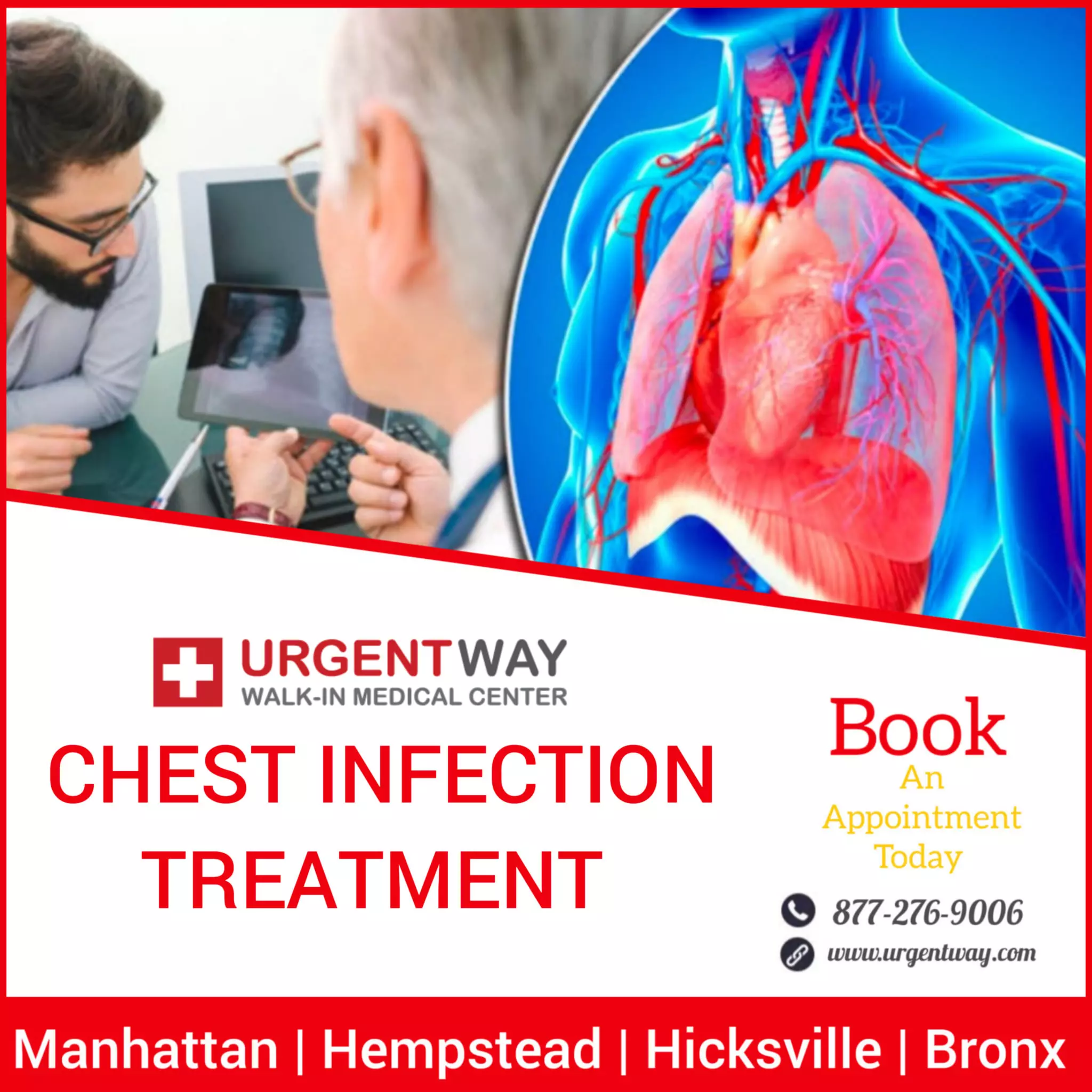 Chest Infection Treatment | PDF
