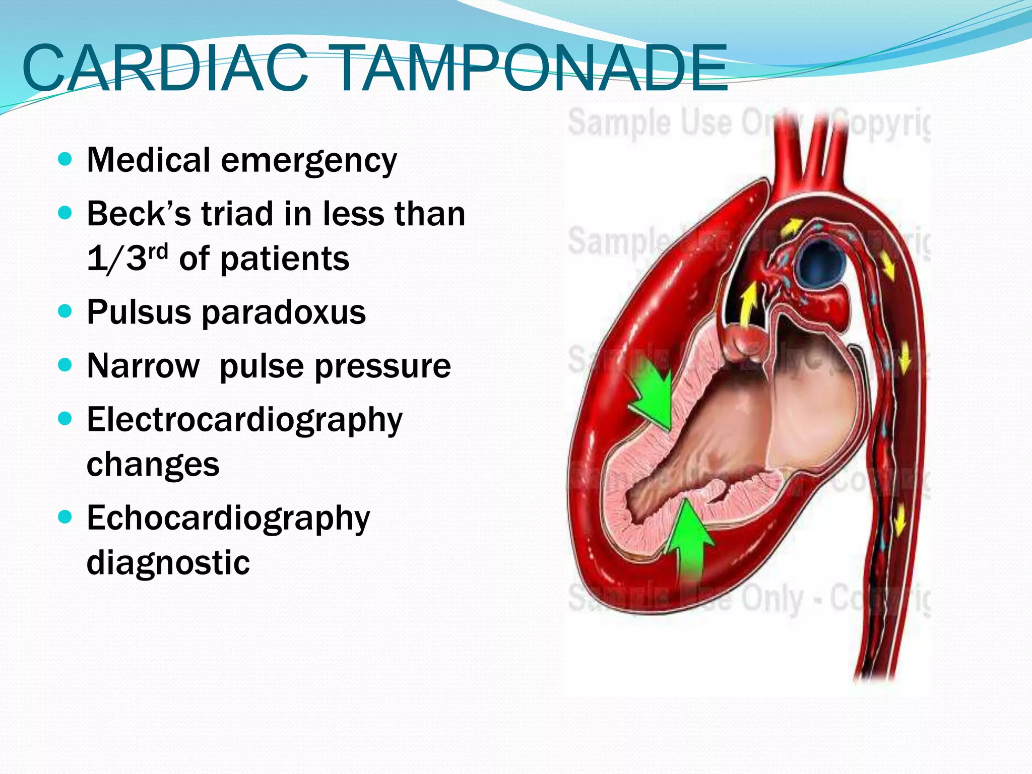 Chest injuries | PPTX