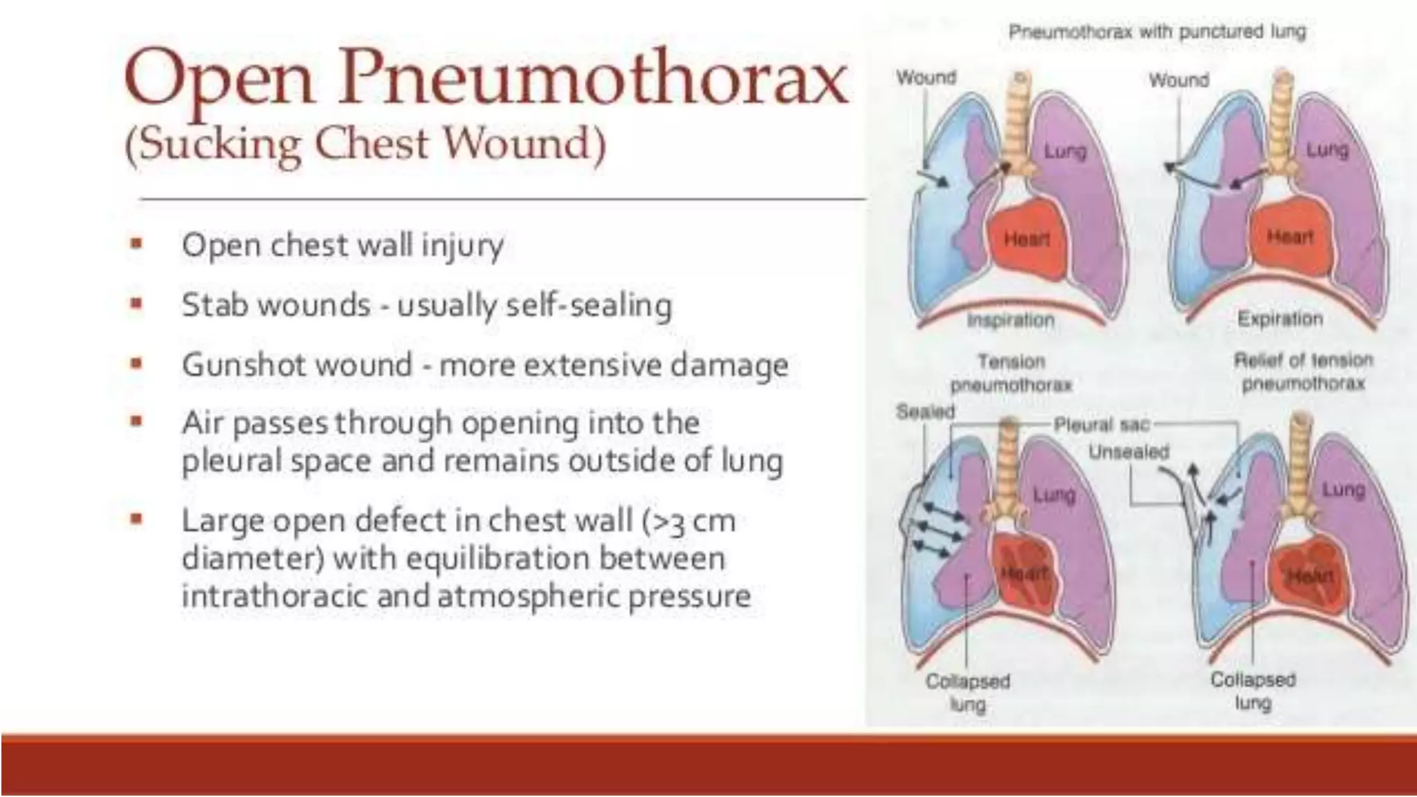 Chest Injuries.pptx | First Aid | Injuries