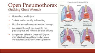 Chest Injuries.pptx | First Aid | Injuries