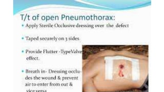 Chest Injuries.pptx | First Aid | Injuries