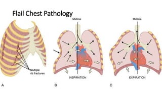 Chest Injuries.pptx | First Aid | Injuries