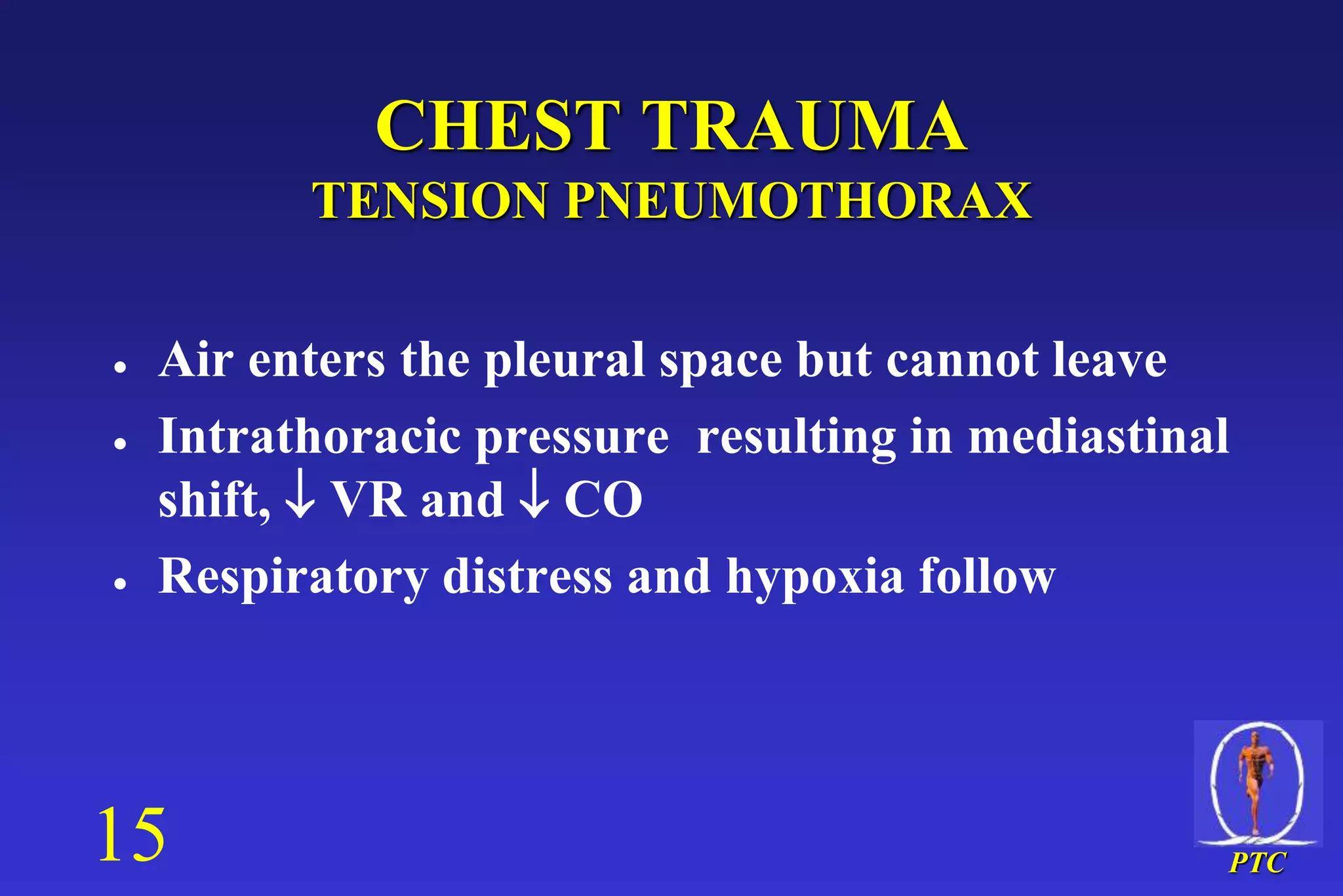 Chest injuries.ppt