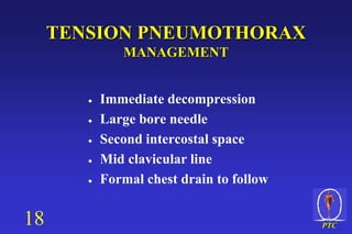 Chest injuries.ppt