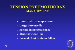 Chest injuries.ppt