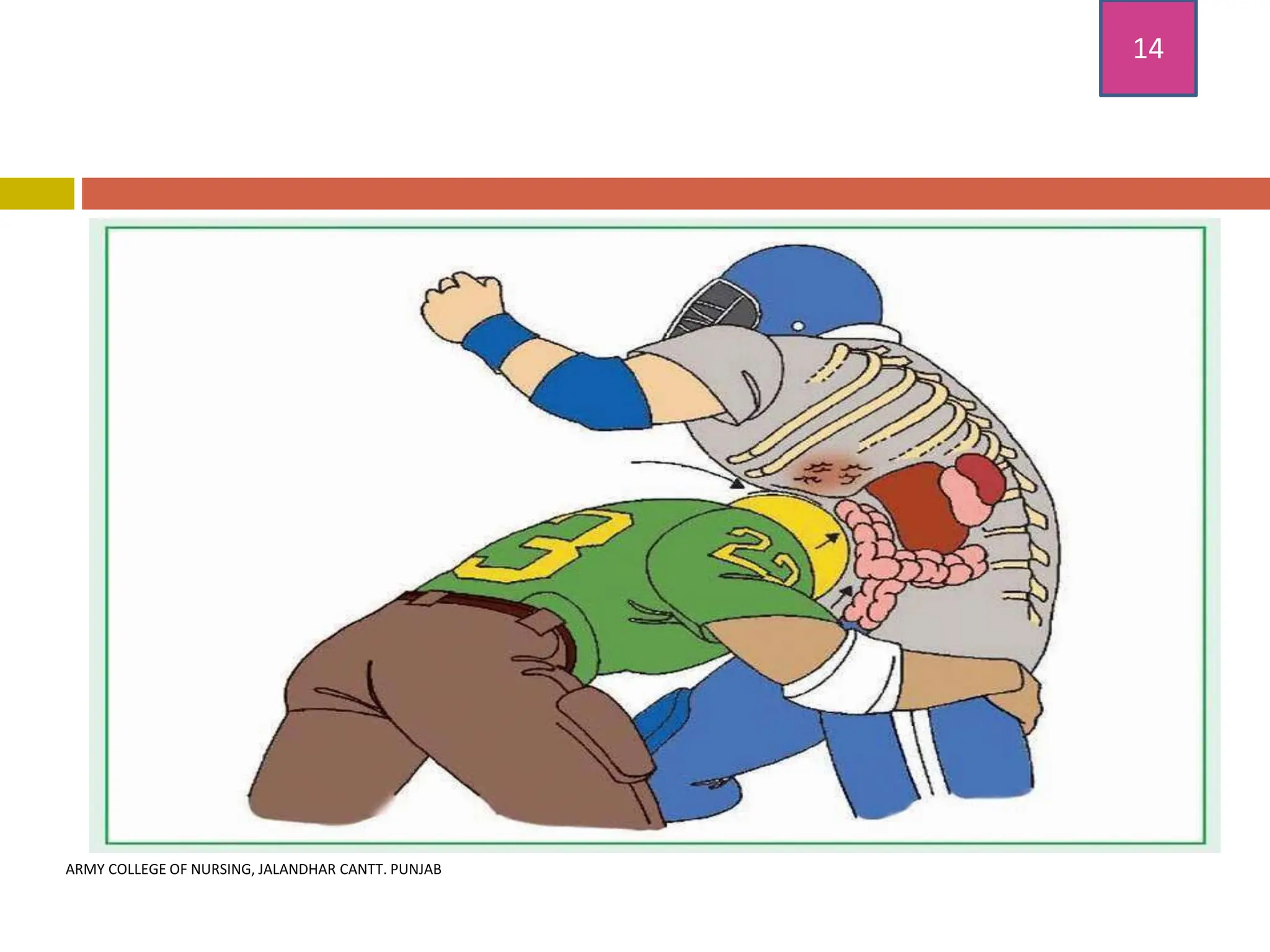 chest injuries and its treatment and nursing management .pptx