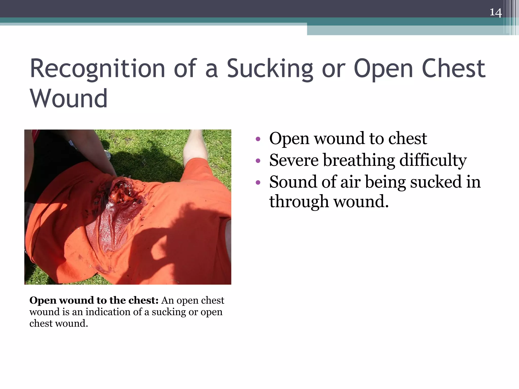 Chest Injuries | PPT