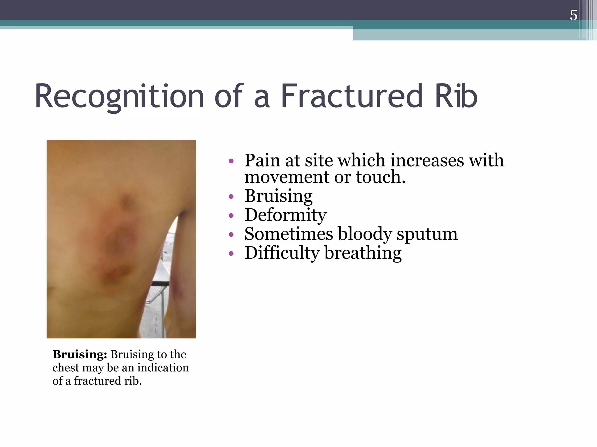 Chest Injuries | PPT