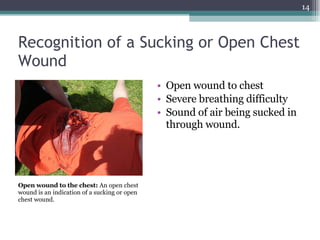 Chest Injuries | PPT