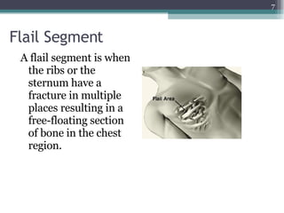 Chest Injuries | PPT