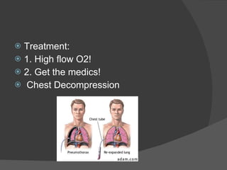 Chest injuries ppt 97 | PPT