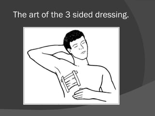 Chest injuries ppt 97 | PPT