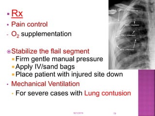 Chest injuries & their management (2) | PPT