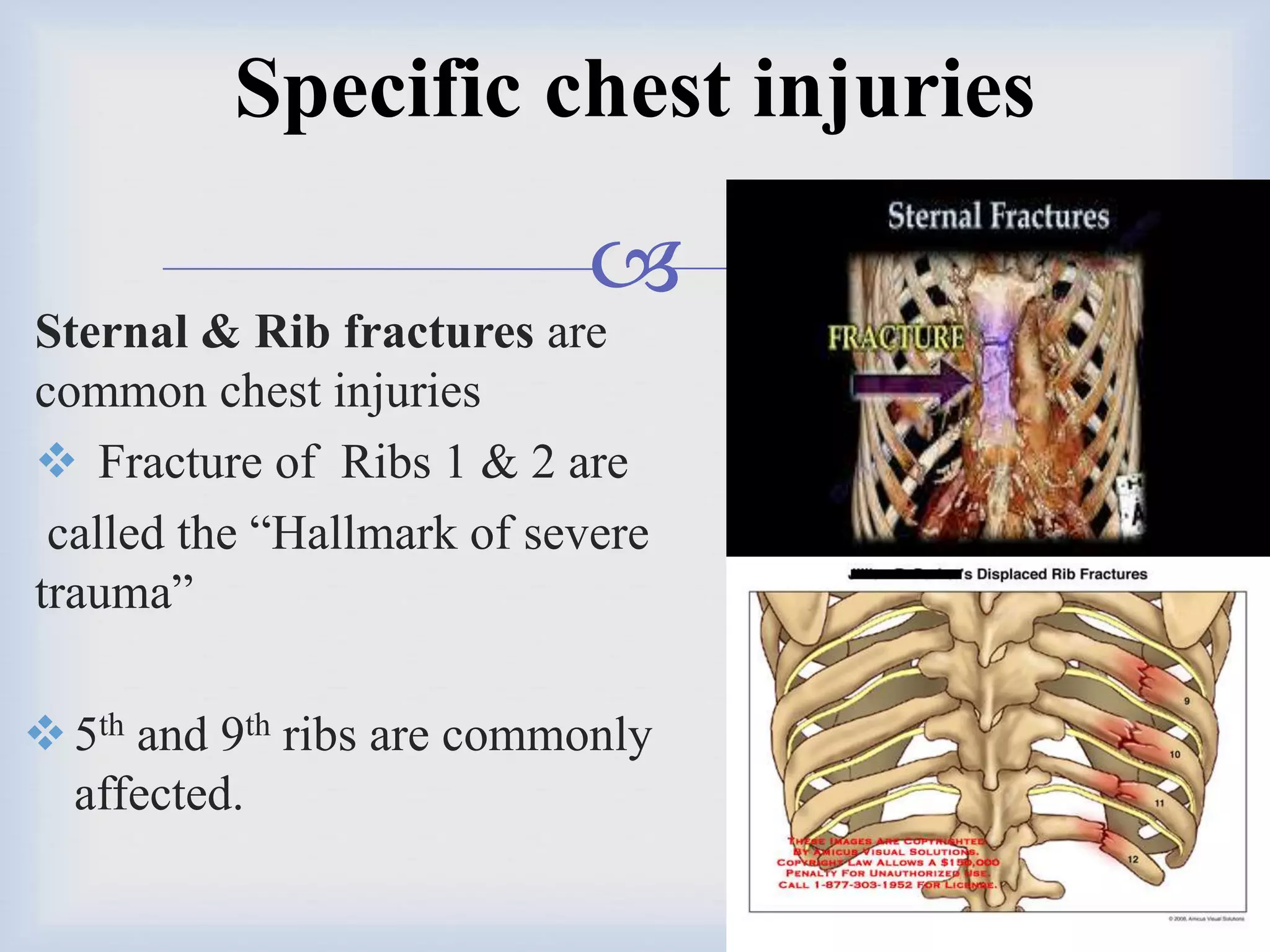 Chest injury | PPTX