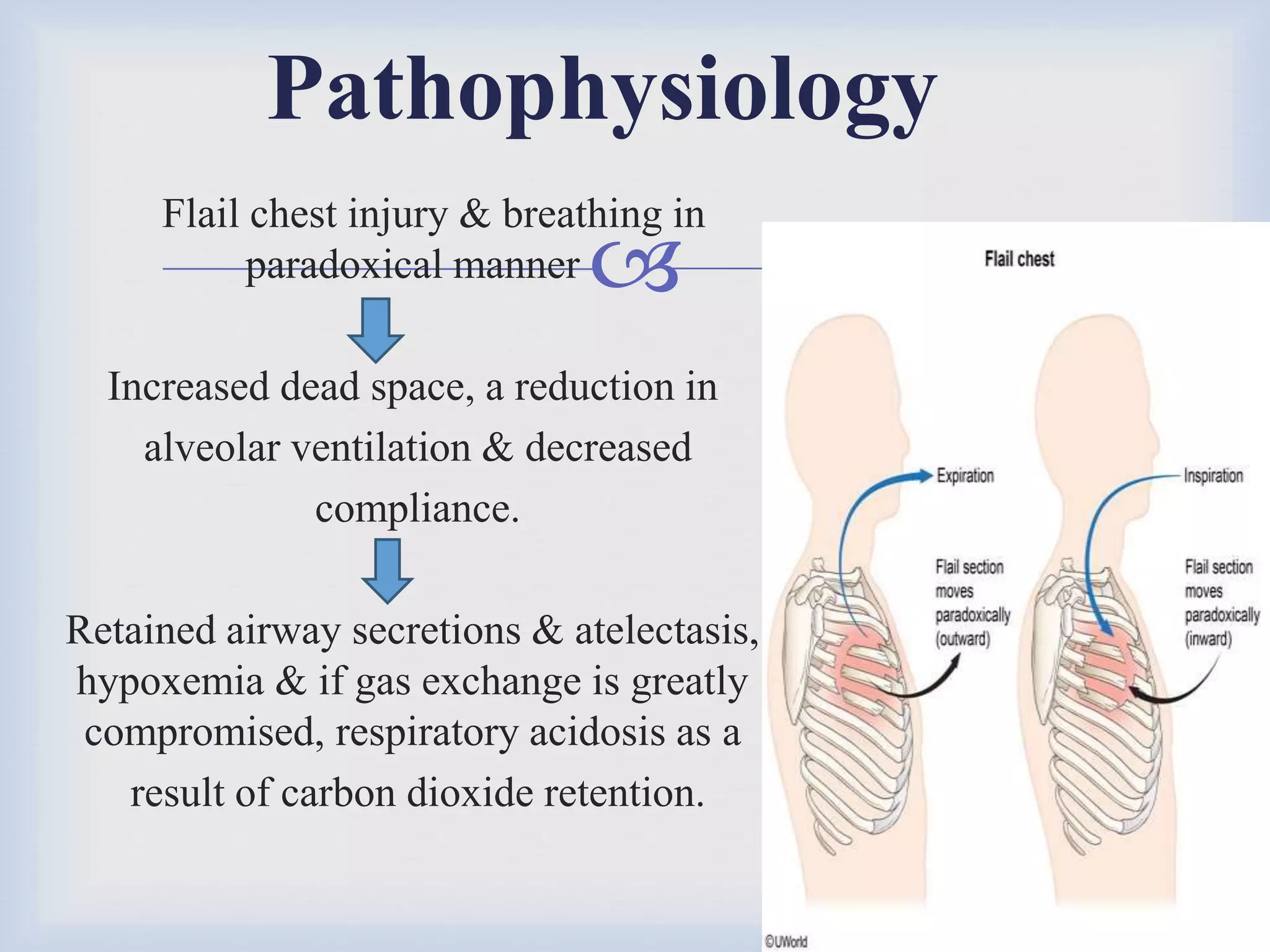 Chest injury | PPTX
