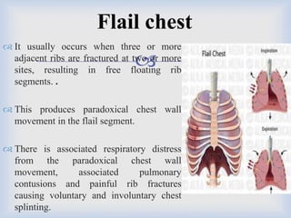 Chest injury | PPTX