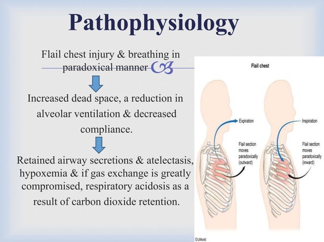 Chest injury | PPTX