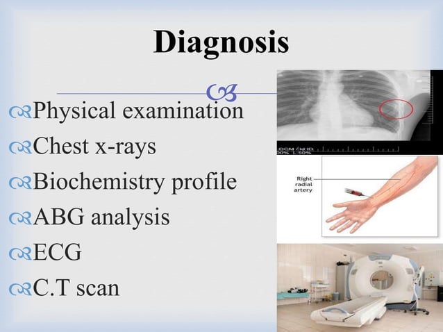 Chest injury | PPTX