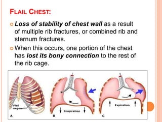 Chest injury and nursing care | PPTX