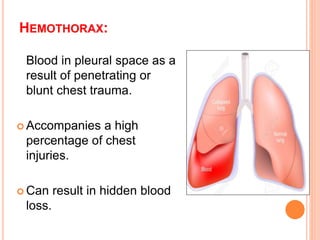 Chest injury and nursing care | PPTX
