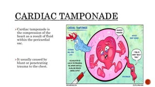 chest injury.pptx, hemothorax# pneumothorax # management | PPTX