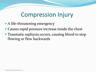 Chest injury.ppthfdsghjbvfvvbbbjjjhvdsdg | PPT