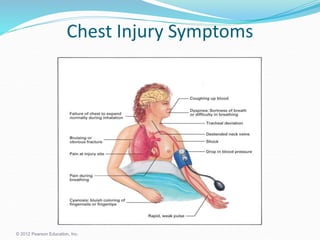 Chest injury.ppthfdsghjbvfvvbbbjjjhvdsdg | PPT