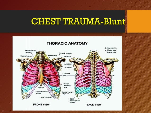 CHEST INJURY- BLUNT- Trauma Surgery | PPT | Death, Injury, or Military ...