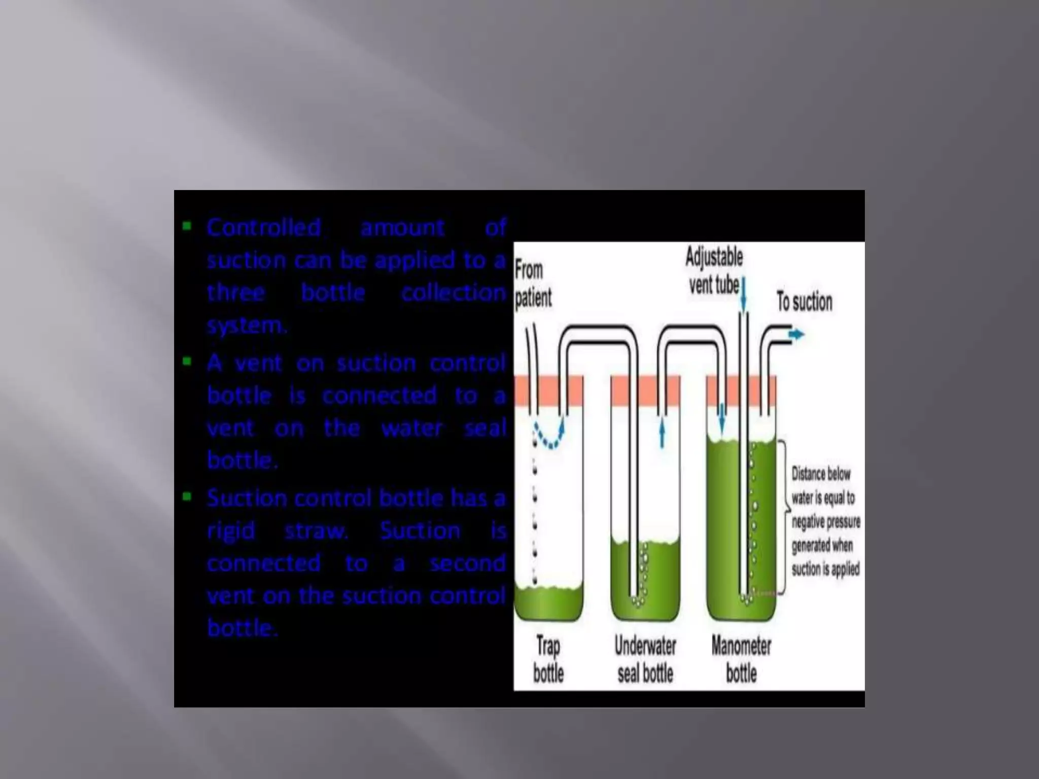 Chest intubation indications,precautions and management | PPTX