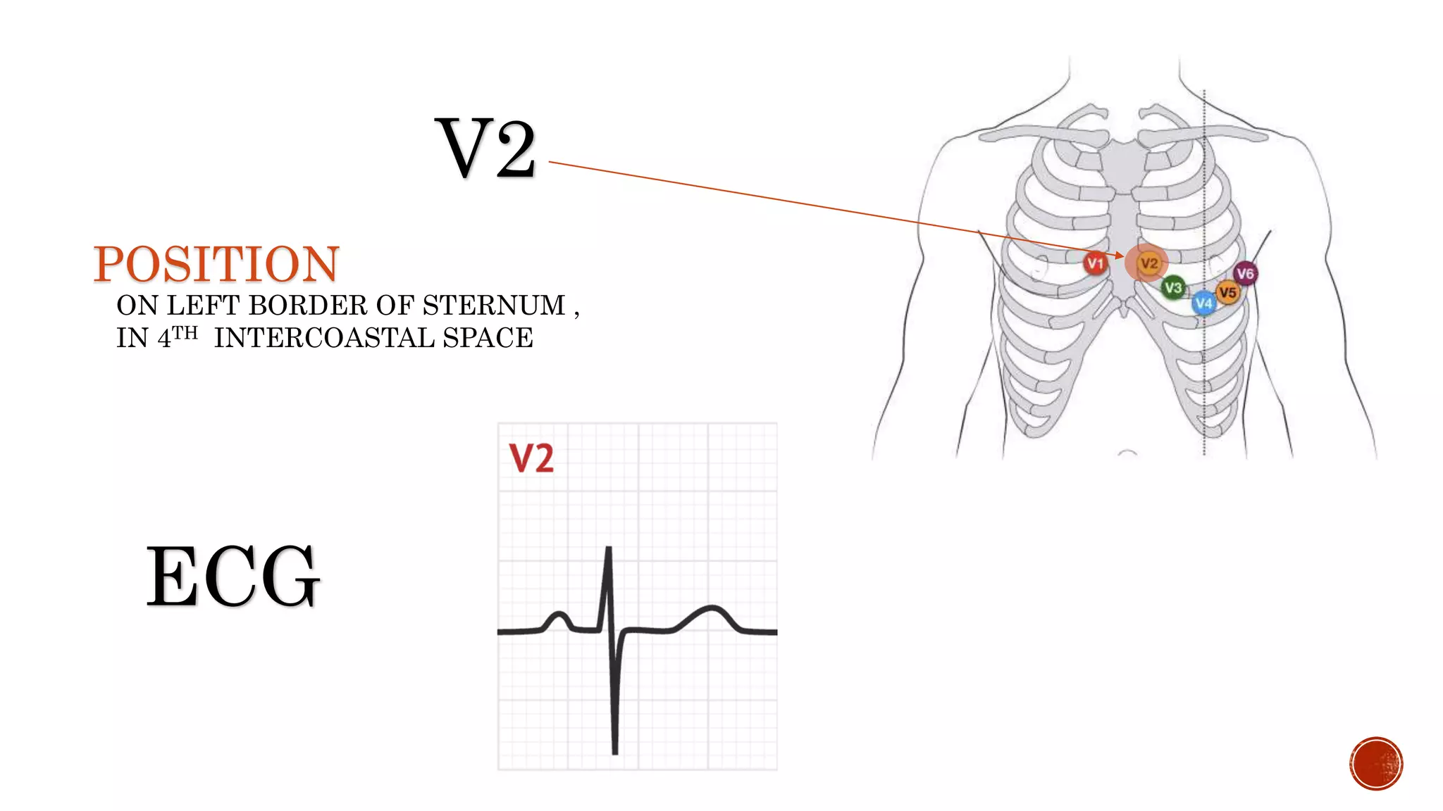 CHEST LEADS.pptx