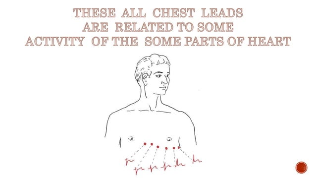 CHEST LEADS.pptx