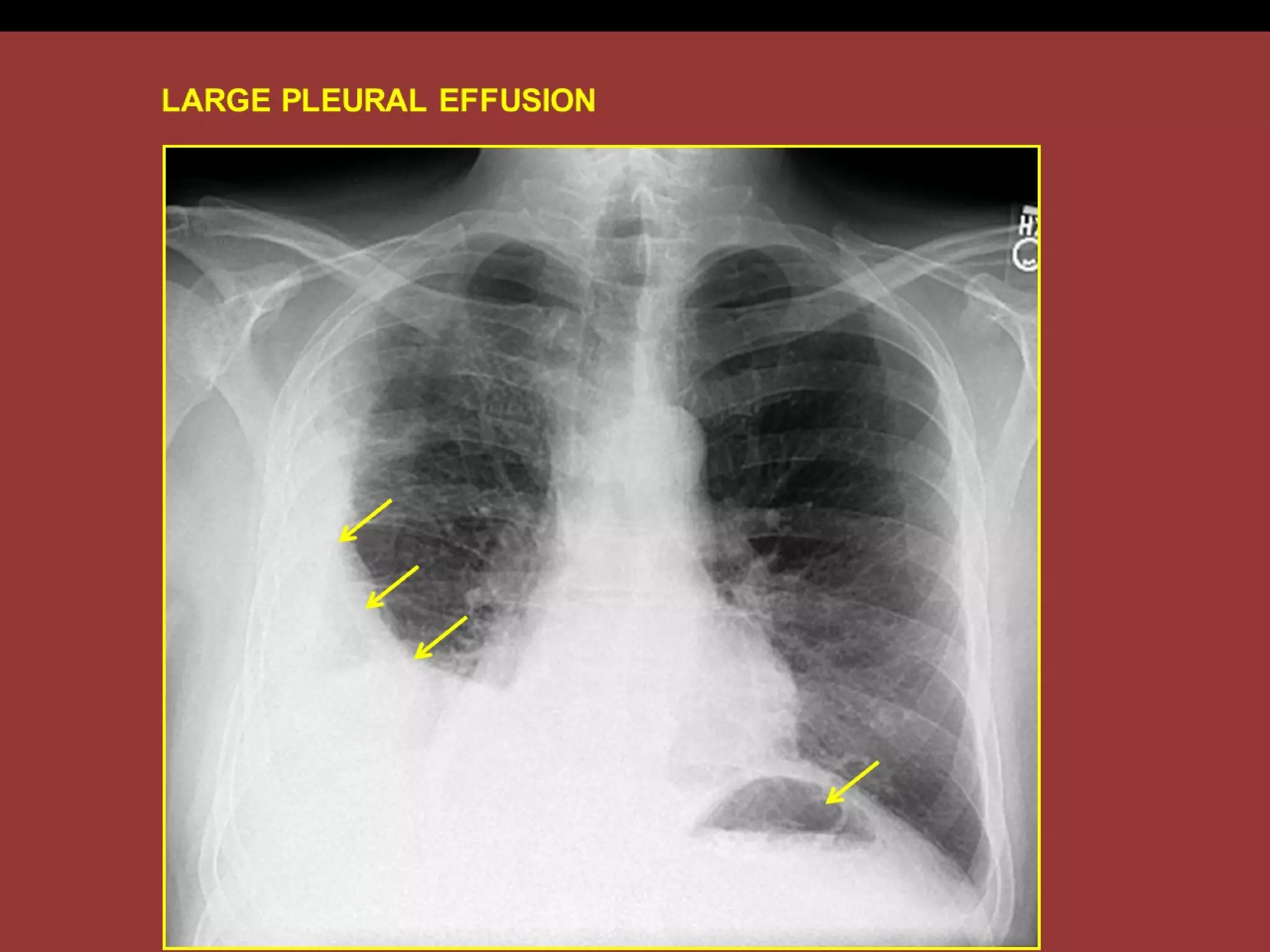Chest overlays for web ss and unknowns 2012 | PPT